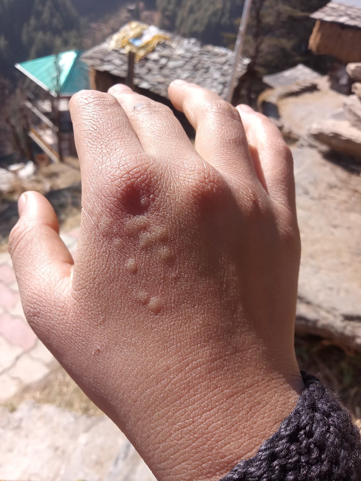 Bichchu Booti- a fierce plant with the power to sting and to heal ...